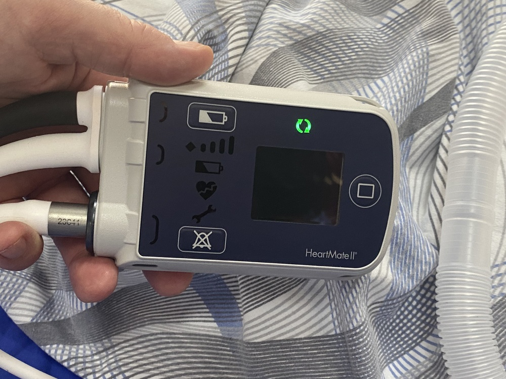 BTA :: 35-Year-Old Gets Artificial Heart Implant in Sofia